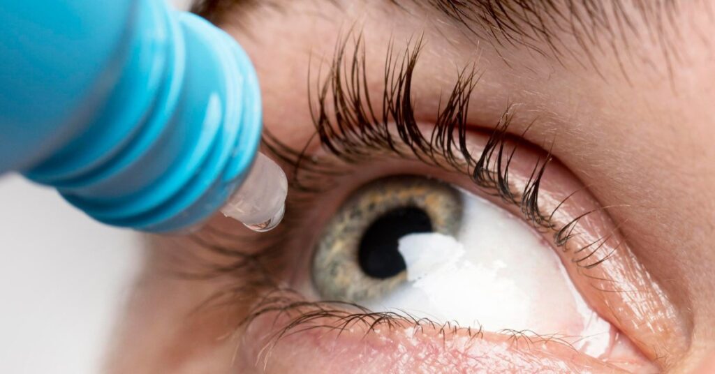 What Is a Contact Solution? Everything You Need to Know